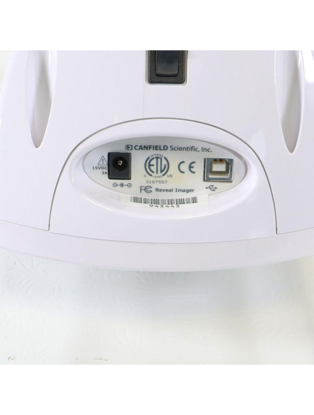 Canfield REVEAL IMAGER Facial Surface Imaging Skin Treatment ...